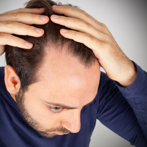 Laser treatment for hair growth | Laser hair regrowth | Shumaila's